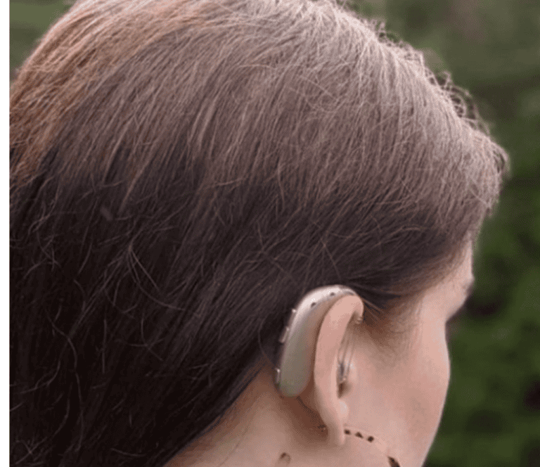 Best Hearing Aids in Secunderabad, Hearing Aid Machine, Ear Machine in ...